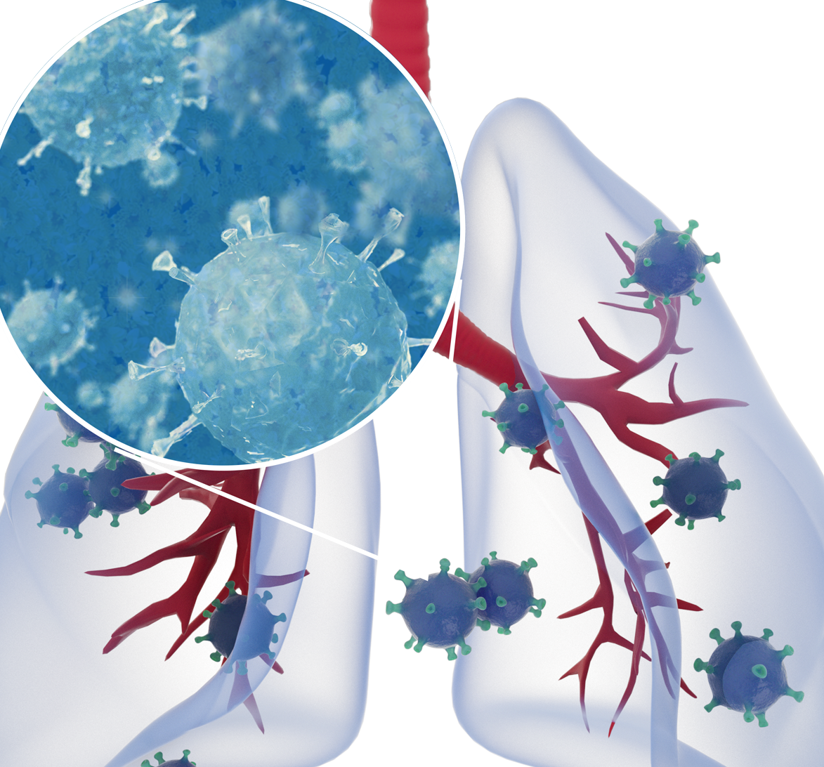 ΚΟΡΩΝΟΪΟΣ: ΥΠΟΠΤΑ ΣΥΜΠΤΩΜΑΤΑ ΚΑΙ ΤΙ ΠΡΕΠΕΙ ΝΑ ΚΑΝΩ | Dr. Σφήκας Γεώργιος