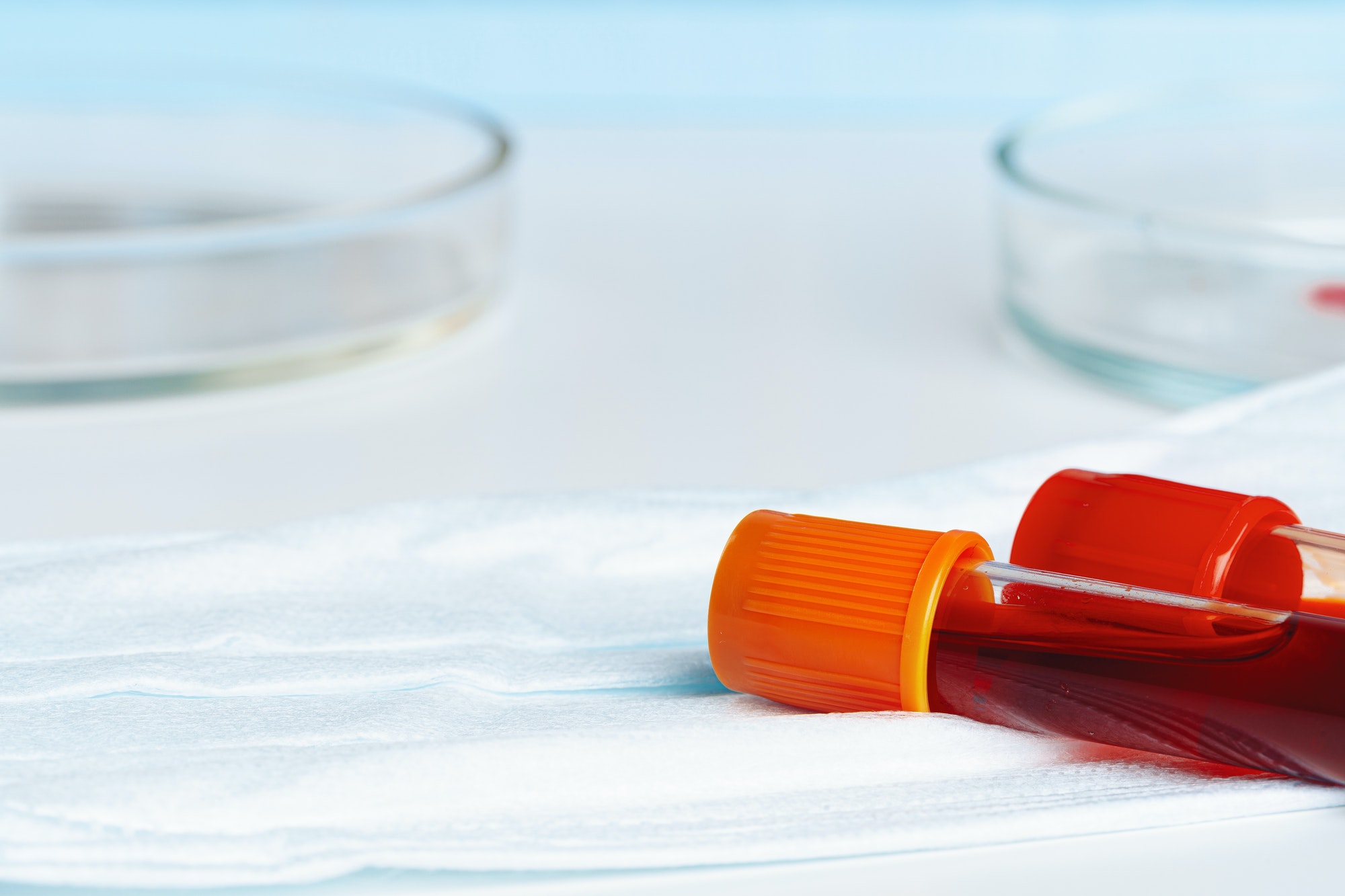 ΔΥΣΛΙΠΙΔΑΙΜΙΑ | Dr. Σφήκας Γεώργιος