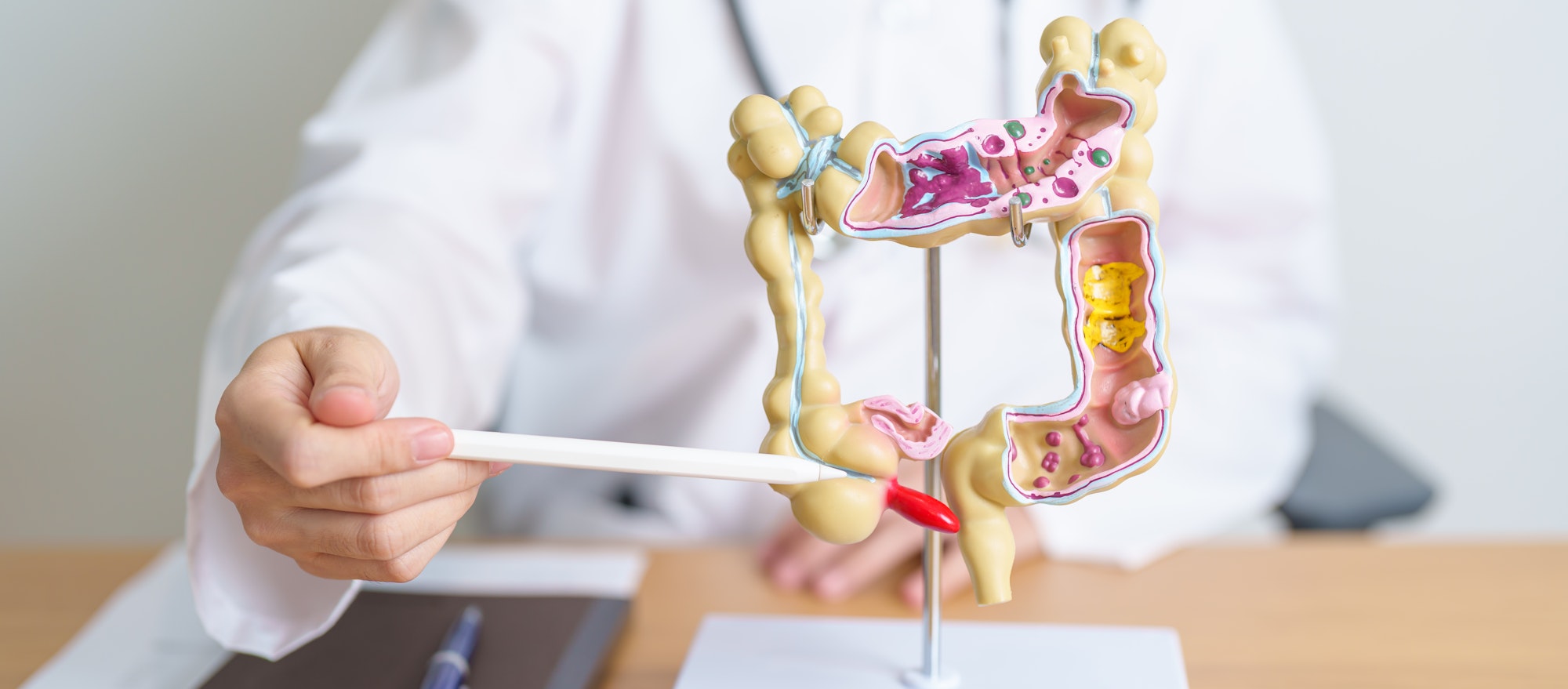 ΟΙΚΟΓΕΝΕΙΑΚΟ ΙΣΤΟΡΙΚΟ ΚΑΡΚΙΝΟΥ ΤΟΥ ΠΑΧΕΟΣ ΕΝΤΕΡΟΥ: ΤΙ ΠΡΕΠΕΙ ΝΑ ...